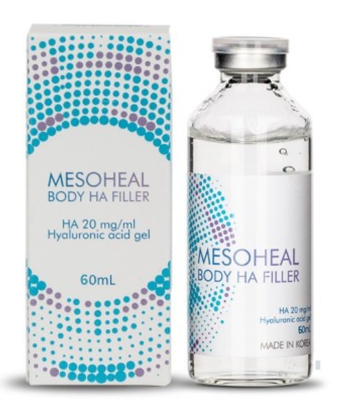 Mesoheal Body HA Filler 1 x 60 ml - Top Dermal